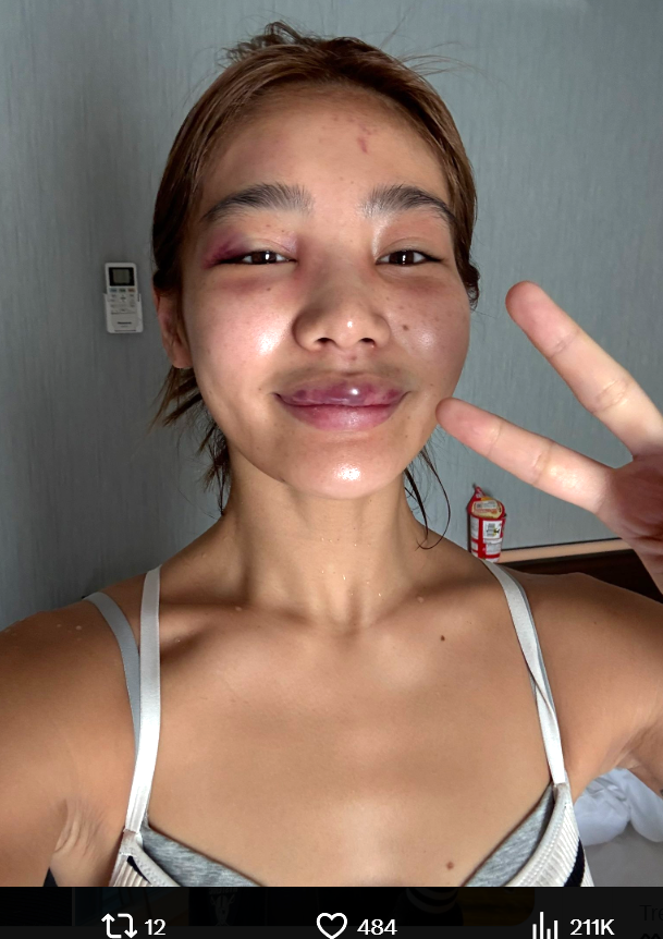 PH02 - eFight【イーファイト】格闘技情報を毎日配信！