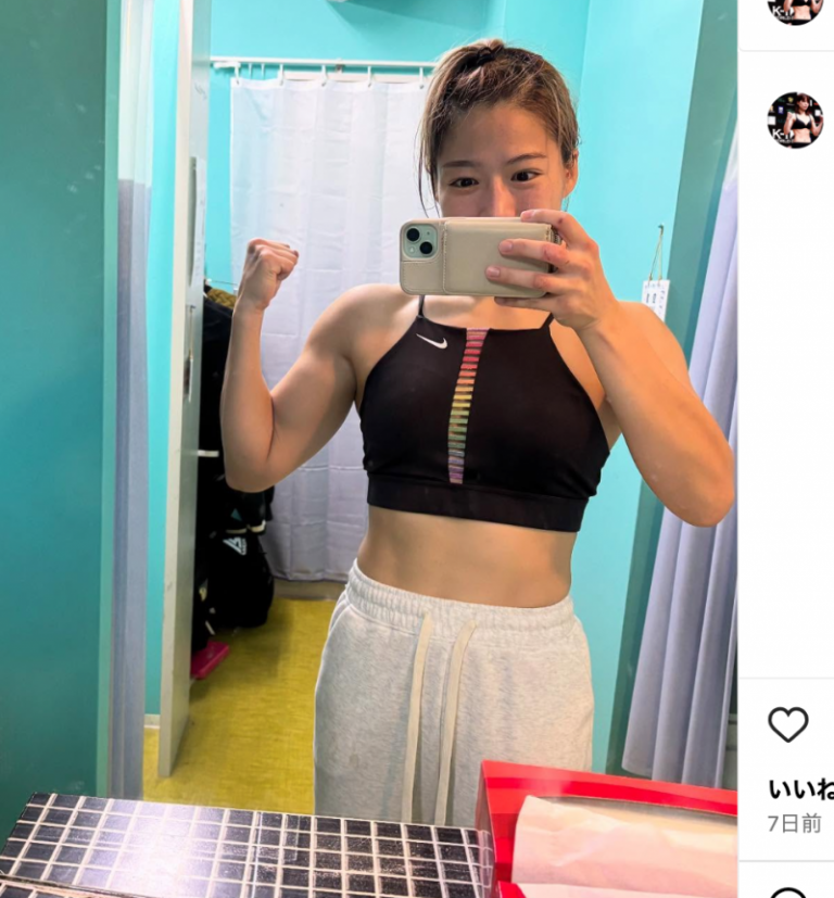 まるでパンダのような”殴られ顔”！“流血マドンナ”鈴木万李弥、激闘後のアザ姿に「美しいお顔が…」 - eFight【イーファイト】格闘技情報を毎日配信！